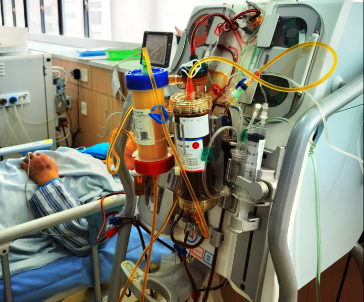 闸中心肾内科成功开展首例人工肝“双重血浆分子吸附系统（DPMAS）”治疗技术